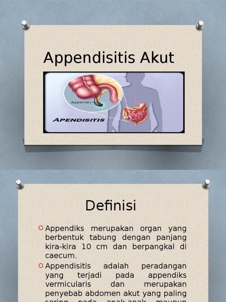 Appendisitis Akut | PDF