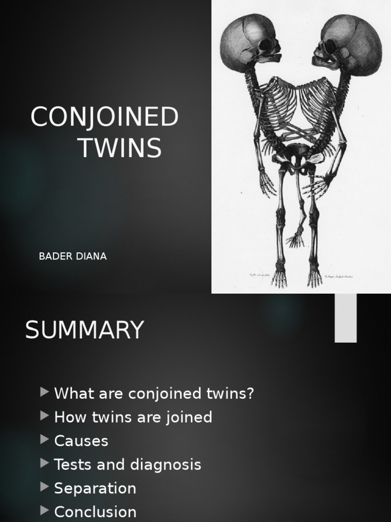 Understanding Conjoined Twins: Causes & Types | PDF | Wellness ...