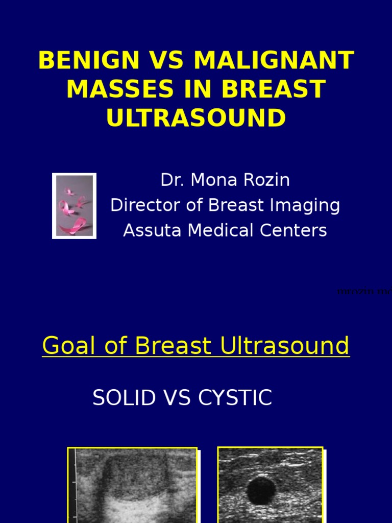 Benign Vs Malignant Masses in Breast Ultrasound | PDF | Breast Cancer ...