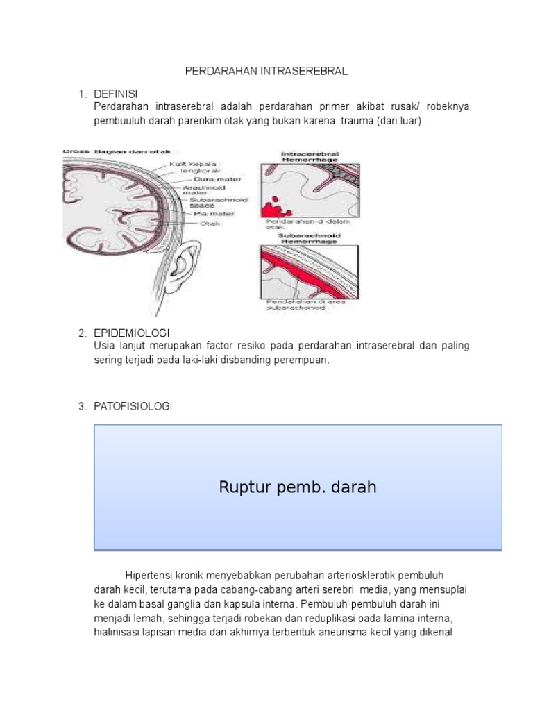 Perdarahan Intraserebral | PDF | Sains & Matematika