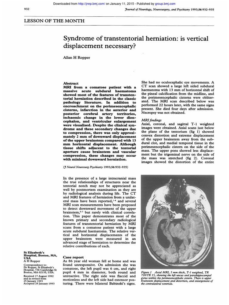 J Neurol Neurosurg Psychiatry 1993 Ropper 932 5 | PDF | Brainstem | Coma