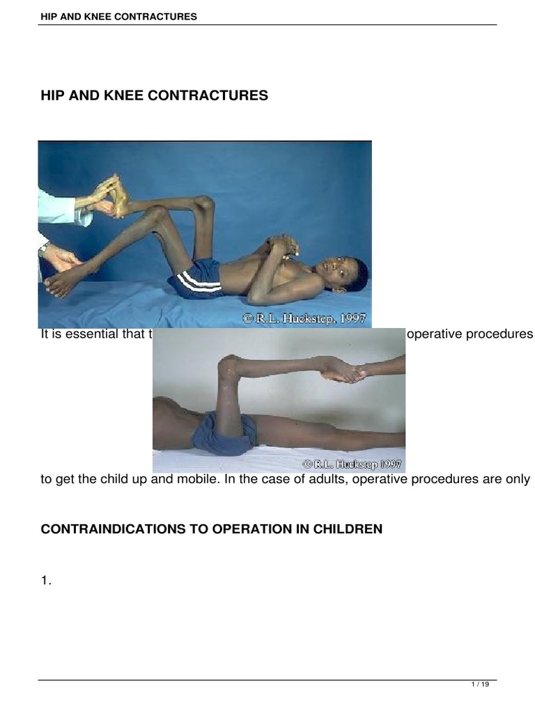 Hip and Knee Contractures PDF | PDF | Knee | Hip