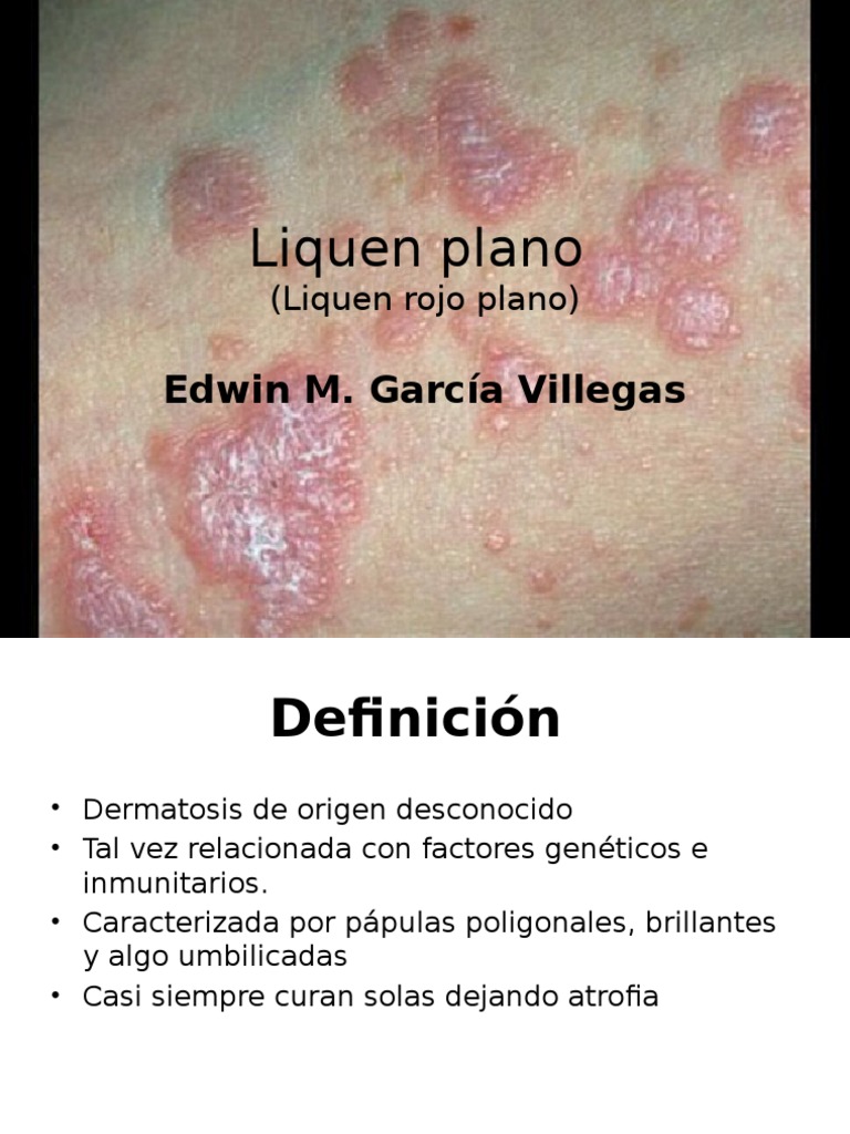 Liquen Plano | PDF | Inmunología | Especialidades Medicas