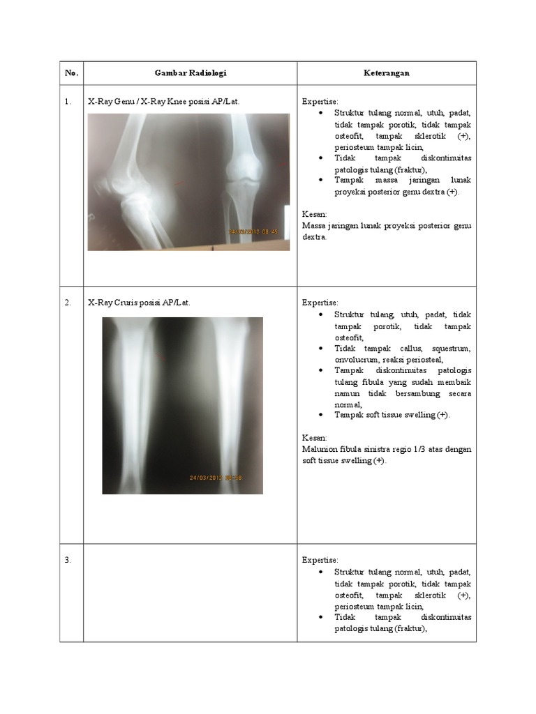 Radiologi Expertise Tulang