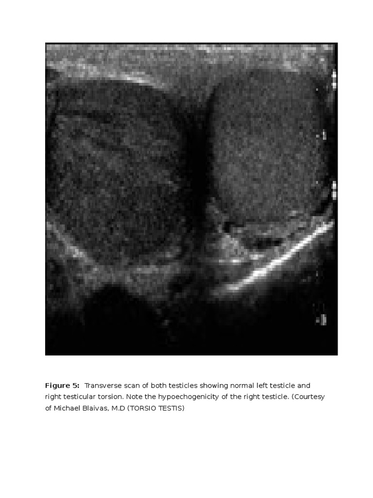 Gambar Usg Testis | Testicle | Medical Ultrasound