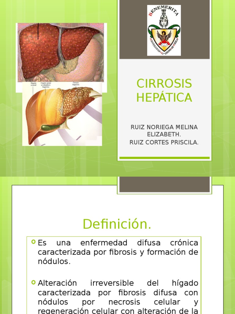 Cirrosis Hepática Final | PDF | Cirrosis | Hígado