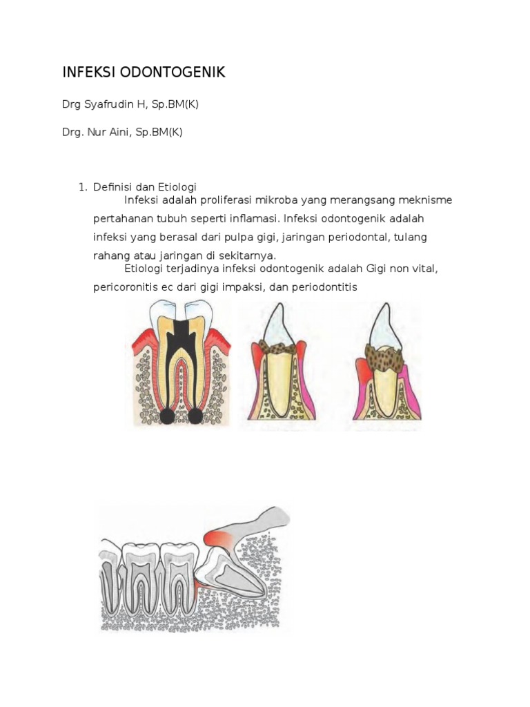 Infeksi Odontogenik | PDF
