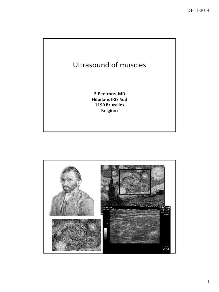 Ultrasound of Muscles | PDF | Muscle | Ultrasound