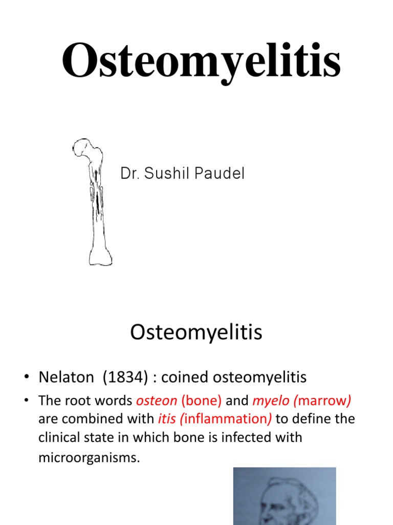 Osteomyelitis 130708212636 Phpapp01 | PDF | Medical Imaging | Infection