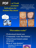 ICCMS and ICDAS Caries Management Guide | PDF | Human Tooth | Tooth Enamel