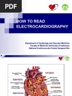 June Nle 2009 SRG Final Coaching | PDF | Heart | Myocardial Infarction