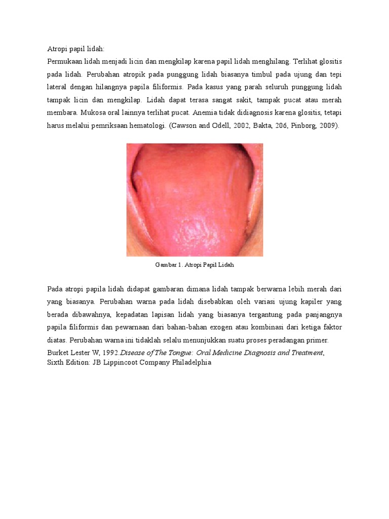 Atropi Papil Lidah | PDF