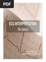 EKG Pocket Guide | PDF | Cardiac Electrophysiology | Electrocardiography