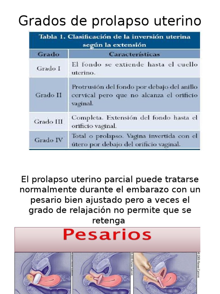 Grados de Prolapso Uterino