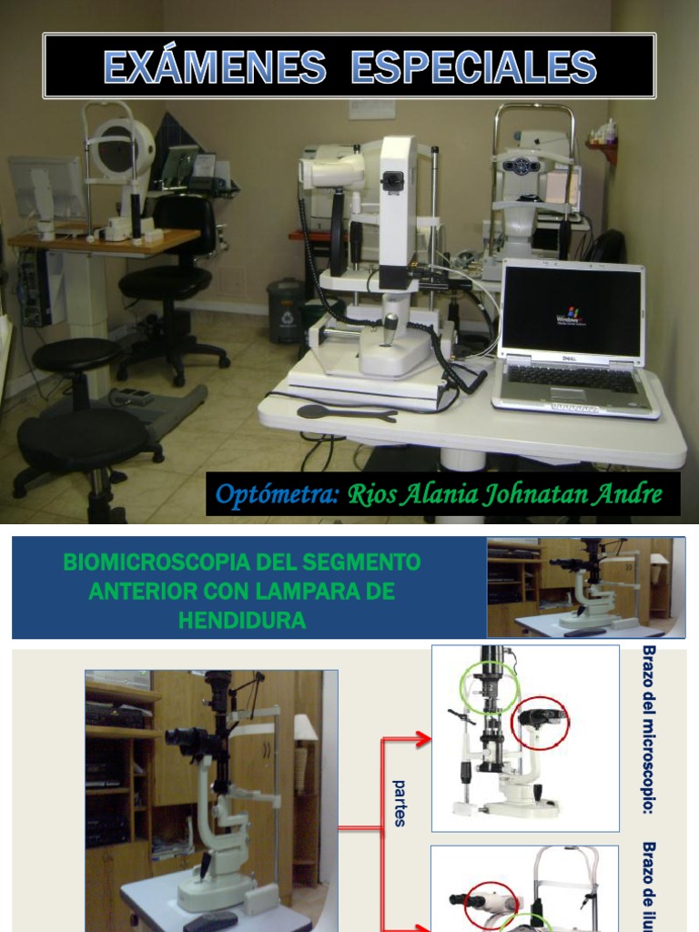 Biomicroscopía, exámenes especiales | Ojo humano | Glaucoma