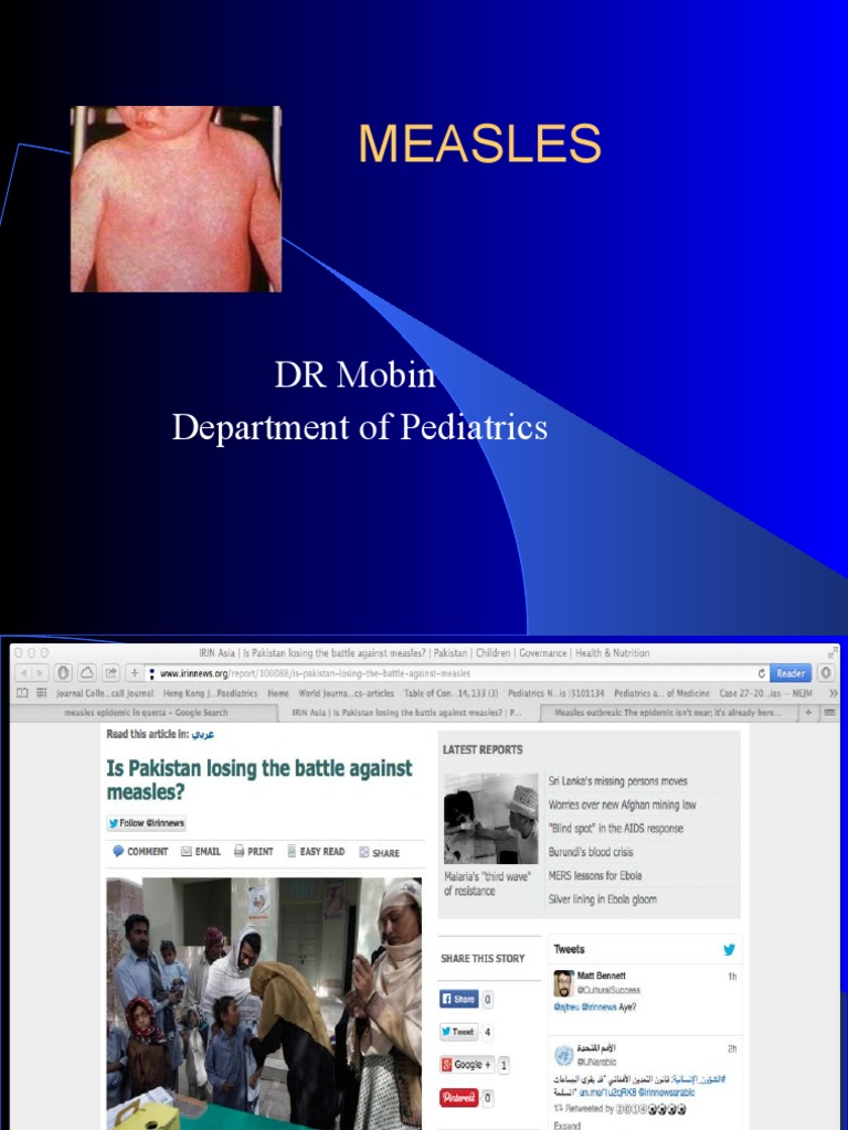MEASLES Presentation | PDF | Measles | Animal Virology