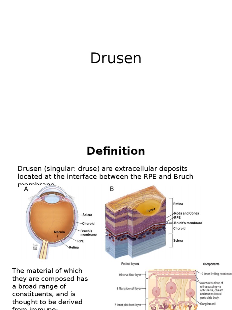 Drusen | Retina | Ophthalmology