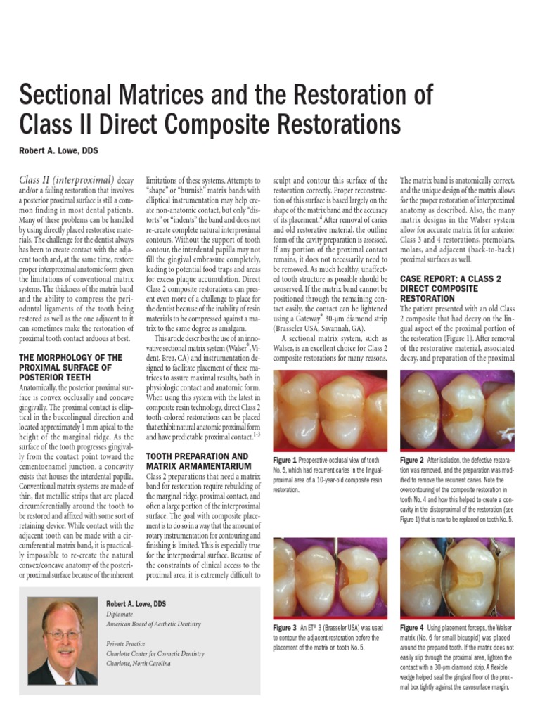 Walser Matrices | PDF | Dental Composite | Composite Material