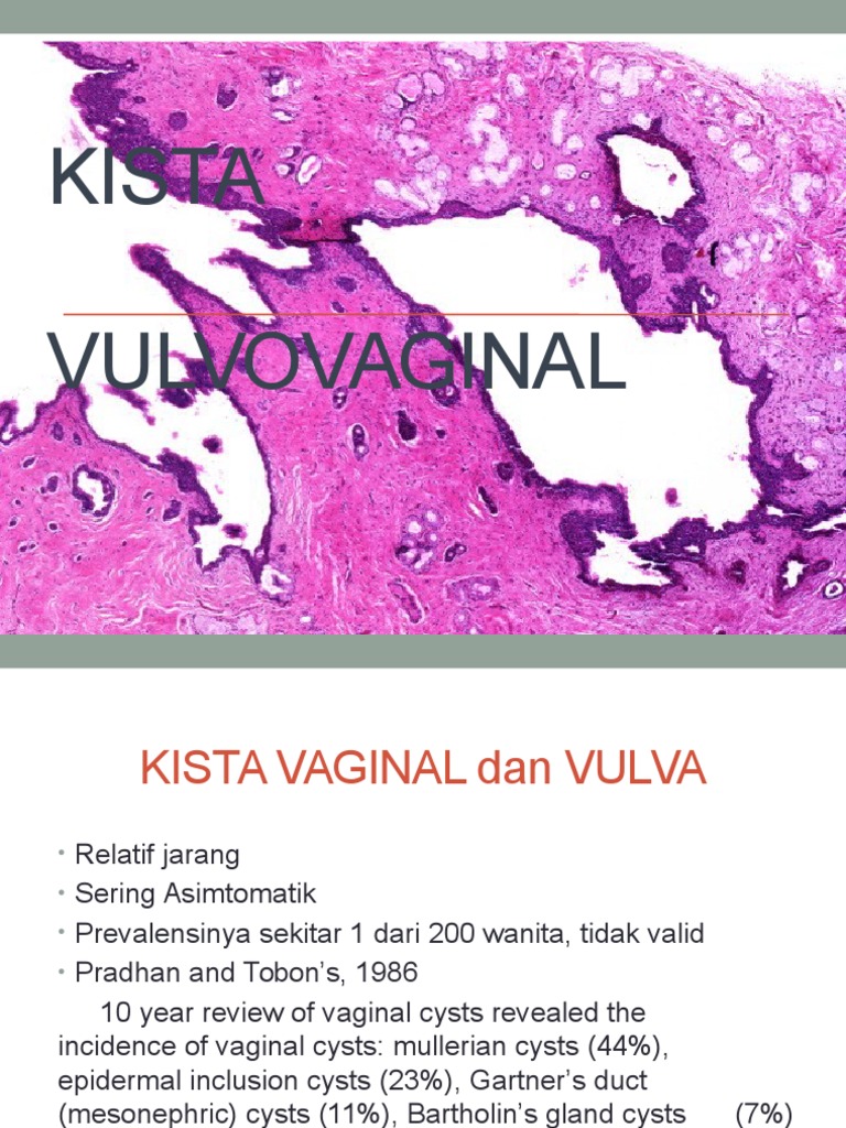 Kista Bartholini | PDF