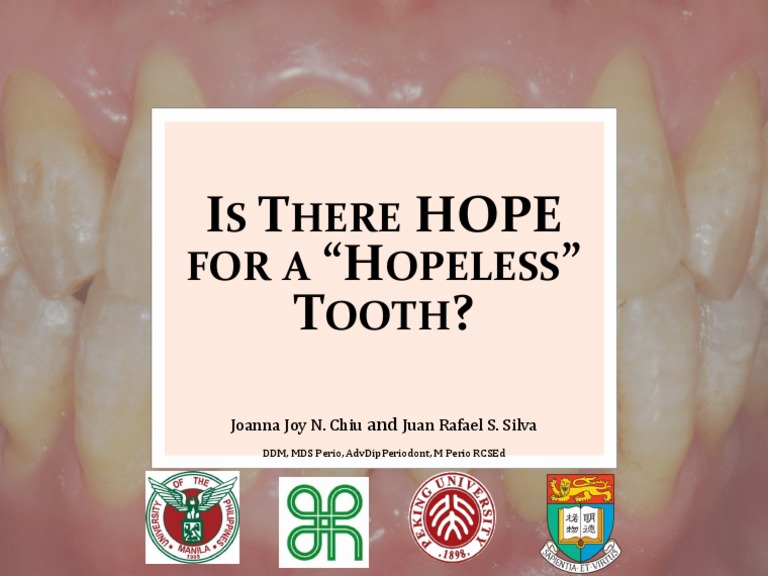 Hope for Hopeless Teeth Solutions | PDF