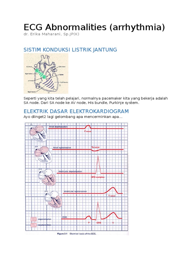 ECG Abnormalities | PDF