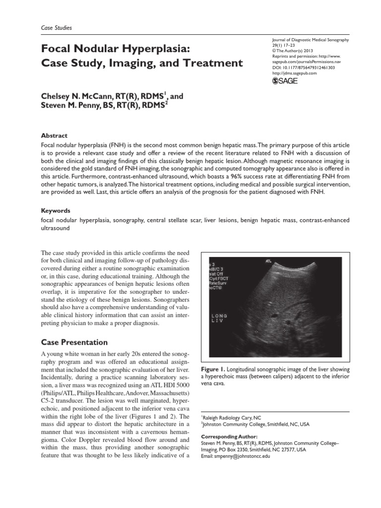 Focal Nodular Hyperplasia | Medical Ultrasound | Liver