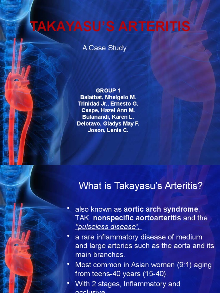 Takayasu's Arteritis | PDF | Dieting | Sleep