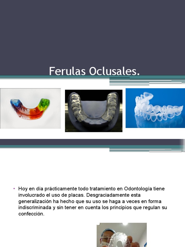 Ferulas Oclusales | Descargar gratis PDF | Diente humano ...