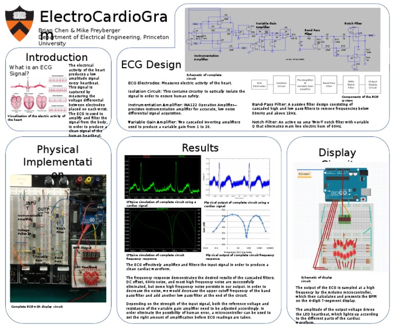 ECG Poster | Amplifier | Electrocardiography
