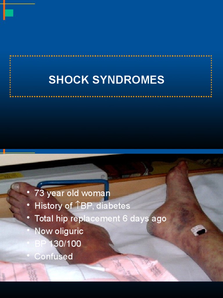 3.ShockSyndrome.pptx | Shock (Circulatory) | Heart