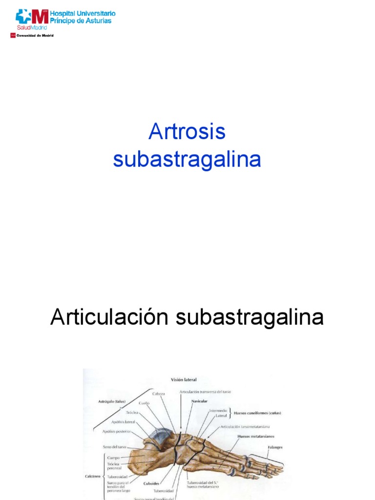 Artrosis Subastragalina: Causas y Tratamientos | PDF | Tobillo | Pie