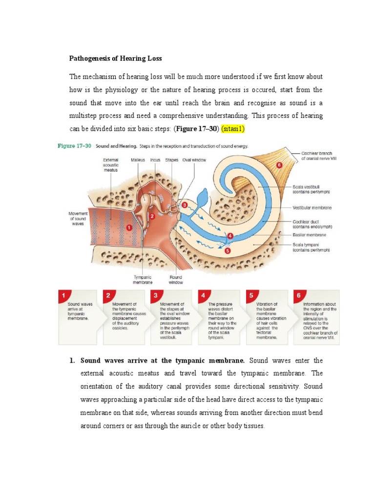 Pathogenesis of Hearing Loss | PDF | Ear | Hearing