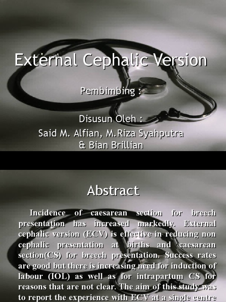 External Cephalic Version | PDF | Caesarean Section | Childbirth