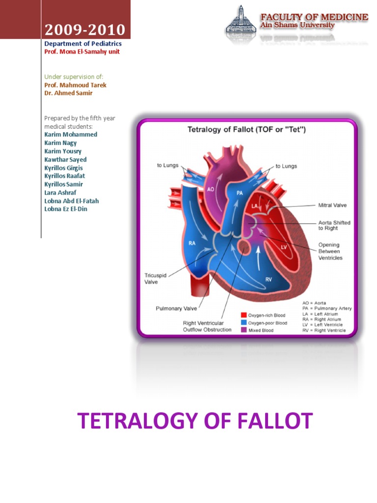 Fallot tetralogy | Congenital Heart Defect | Cardiology