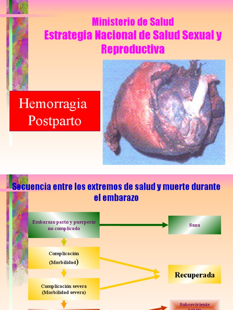011. HEMORRAGIA POSTPARTO | Parto | El embarazo