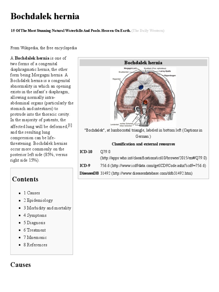 Bochdalek hernia - Wikipedia, the free encyclopedia.pdf | Diseases And ...