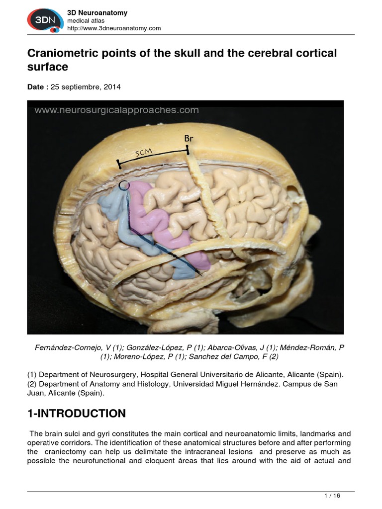 Craniometric Points of the Skull and the Cerebral Cortical Surface | Parietal Lobe | Human Head ...
