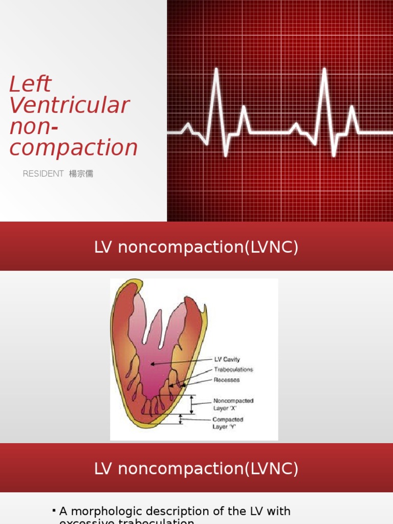 Left Ventricular Non-compaction | Heart Failure | Ventricle (Heart)