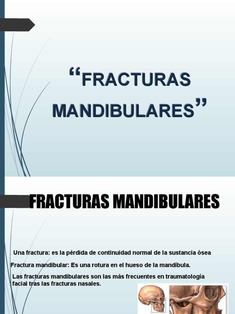 Clasificación y tratamiento de fracturas mandibulares | PDF ...