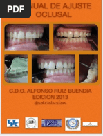 Confección del Jig de Lucia en Odontología | PDF | Ramas de Odontología