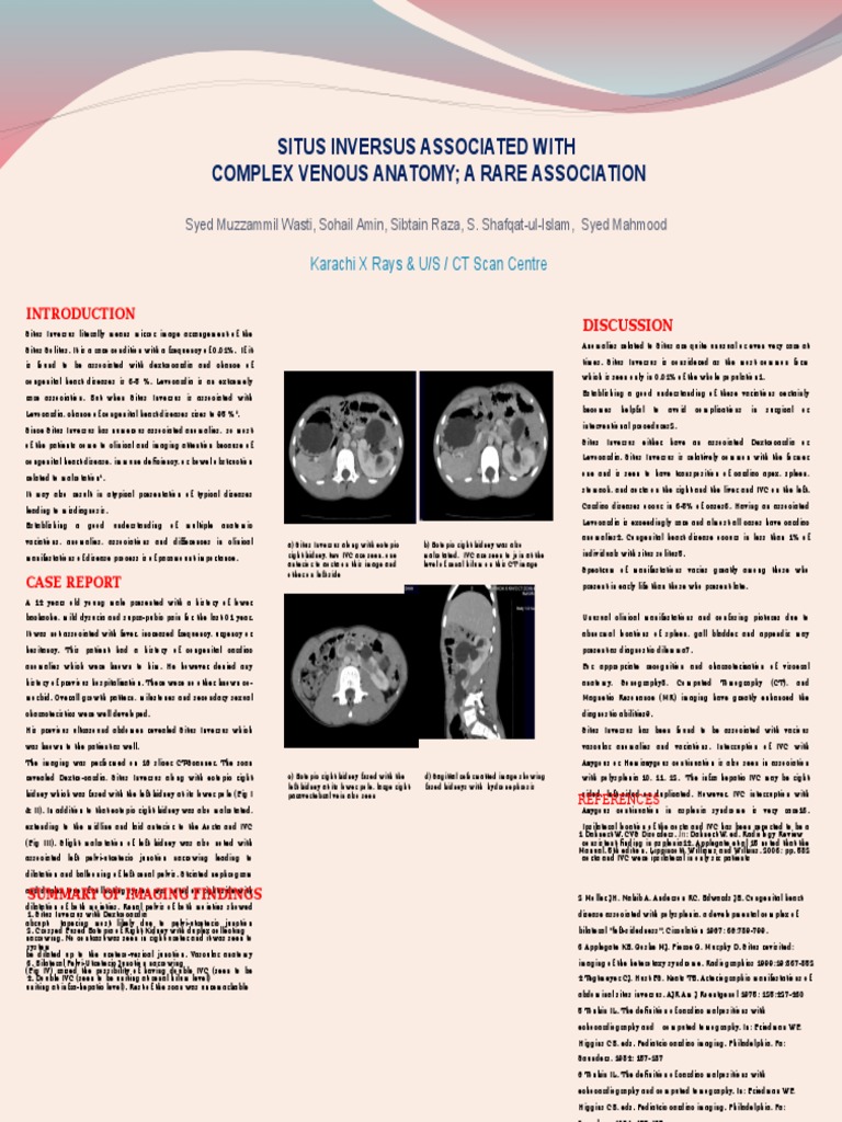Poster Situs Inversus | PDF | Kidney | Heart