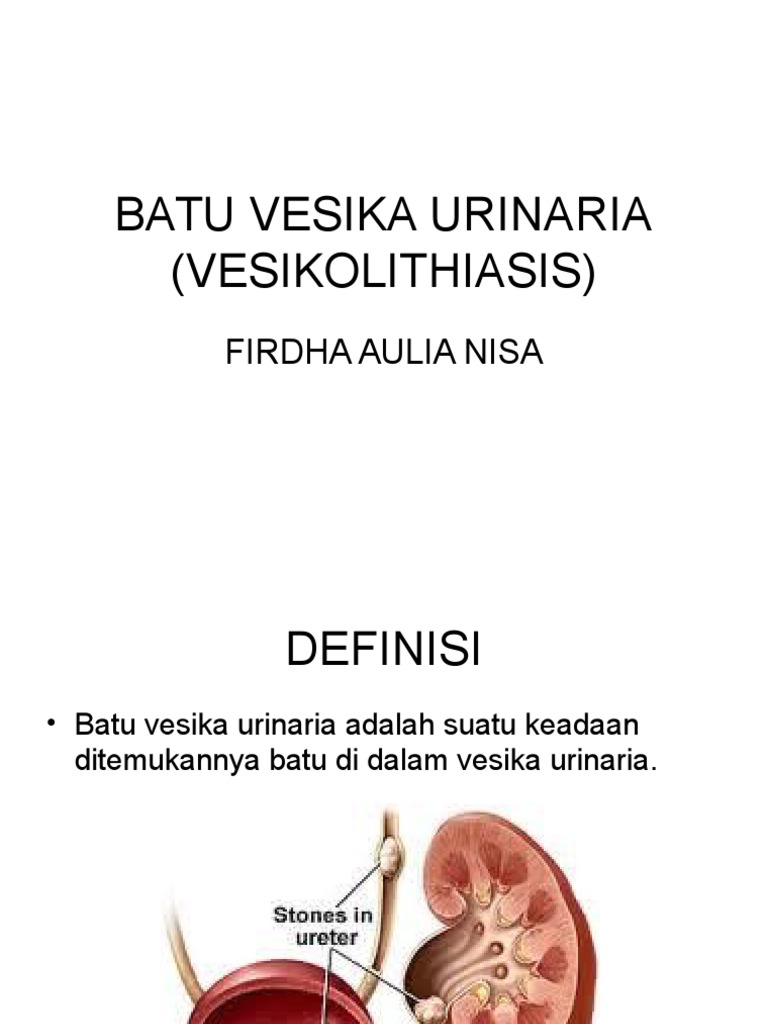 Batu Vesika Urinaria | PDF