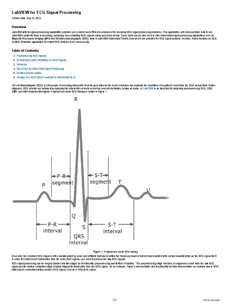 LabVIEW ECG Signal Processing Guide | PDF | Electrocardiography | Wavelet