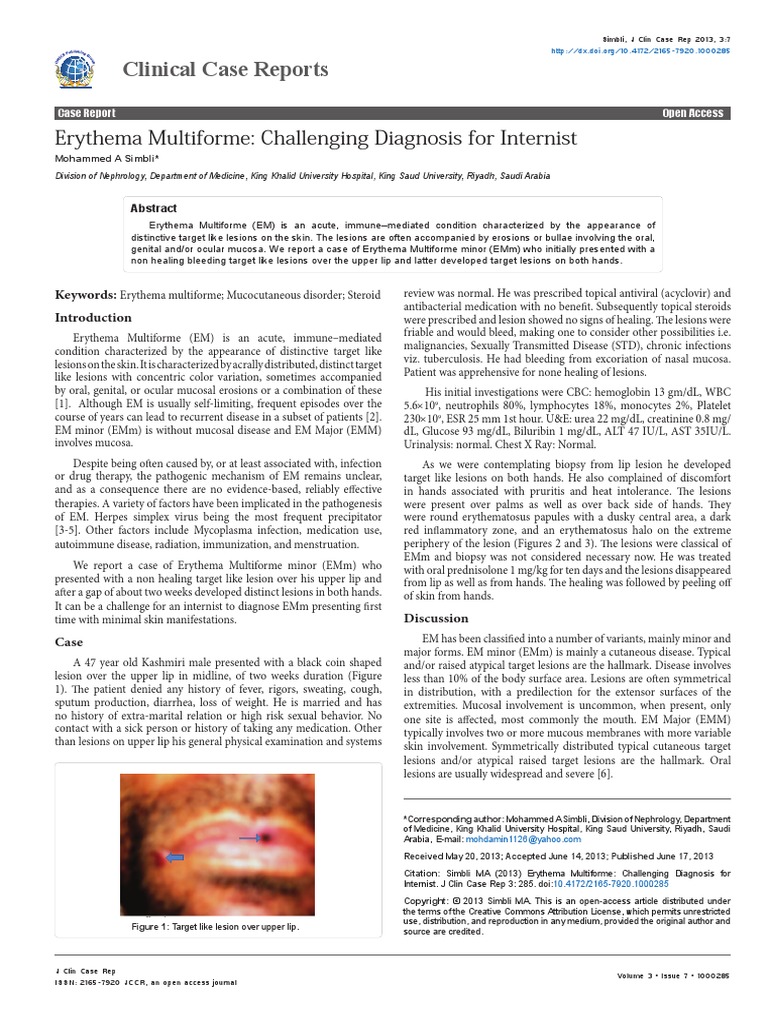 Erythema Multiforme | PDF | Herpes Simplex | Medical Diagnosis