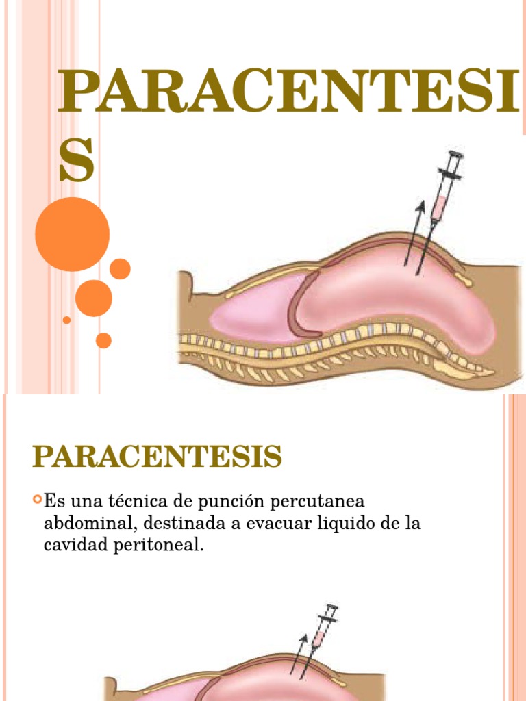 paracentesis.ppt | Especialidades Medicas | Medicina CLINICA