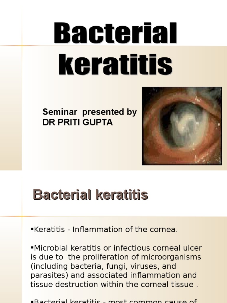 Bacterial Keratitis Symptoms