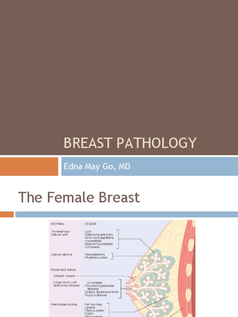 Breast Patho Lect | PDF | Breast Cancer | Cancer