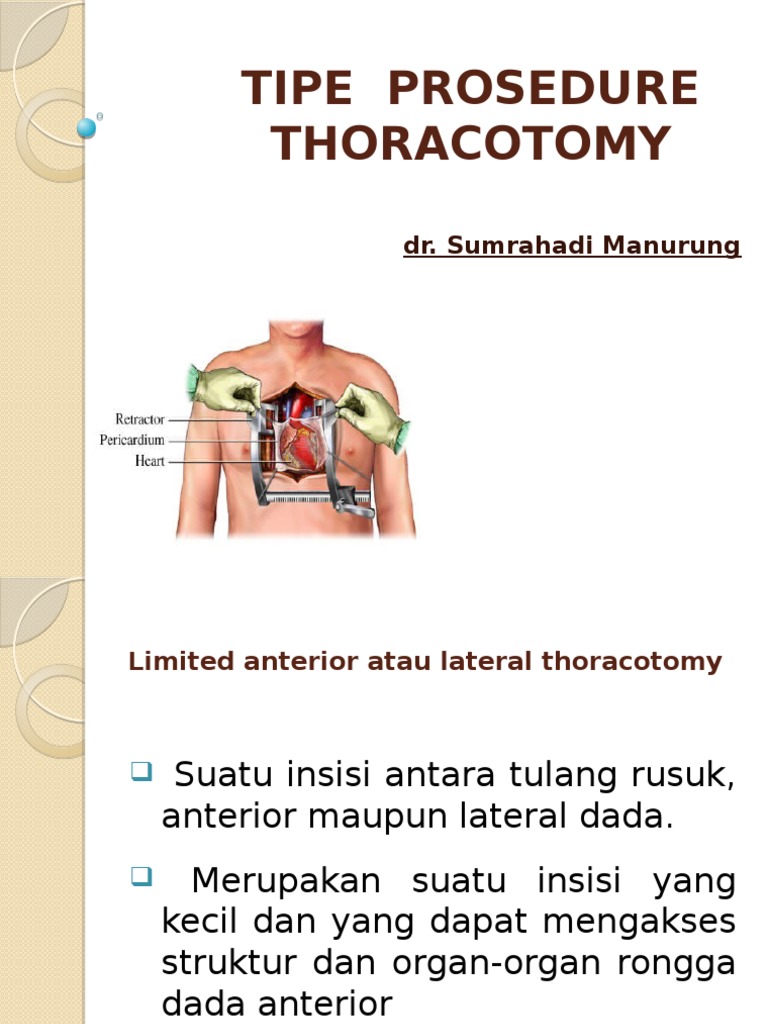 Thoracotomy | PDF