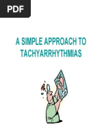 Atrial Fibrillation:Flutter in Pre-Excitation - LITFL - ECG Library ...