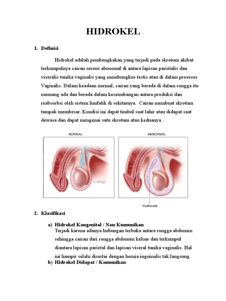 HIDROKEL | PDF | Kesehatan Holistik | Sains & Matematika